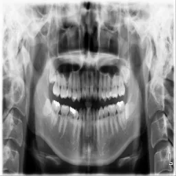 Multi Class Annotated Panoramic Dental X Ray Dataset Dataset by Hecenyu